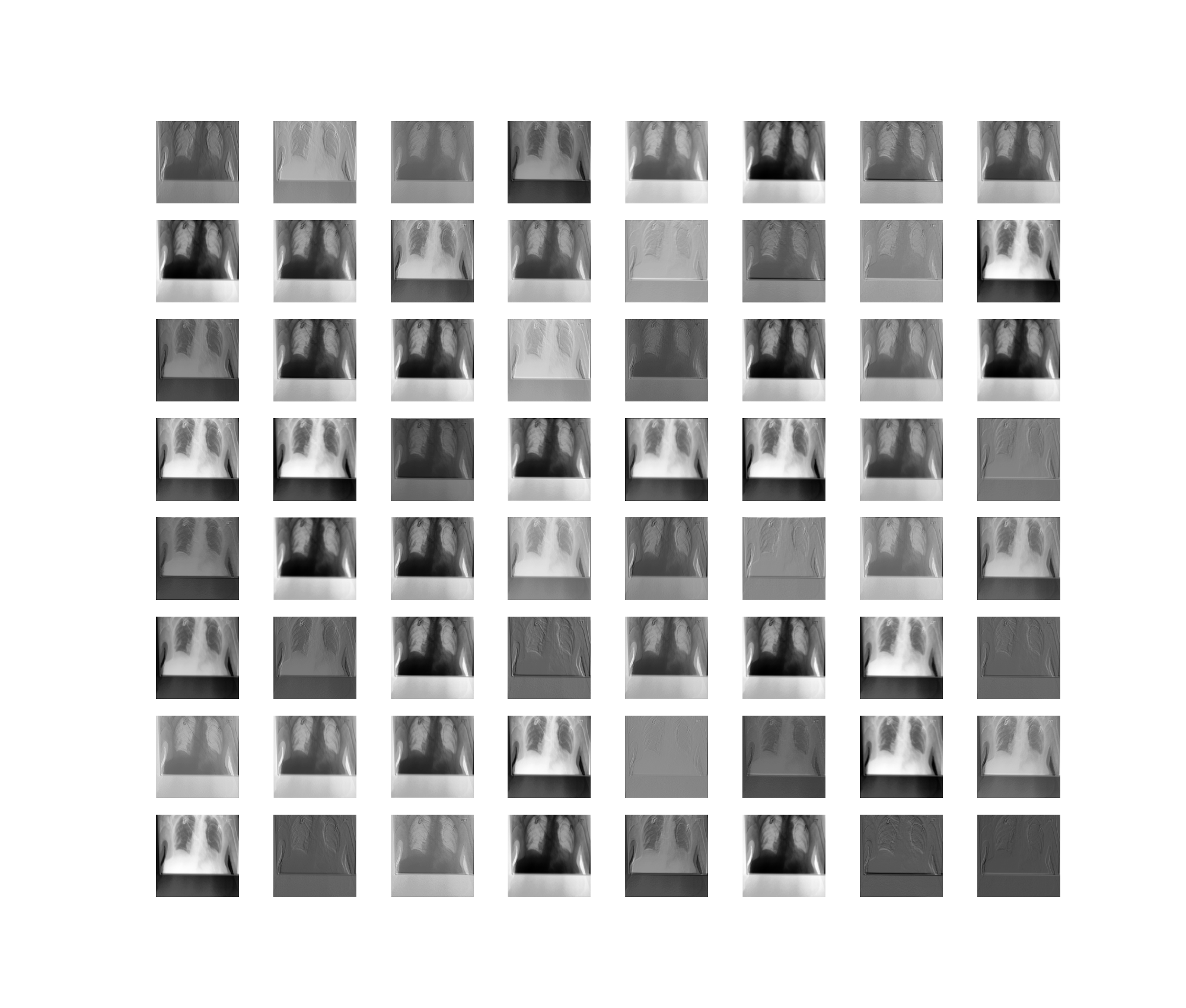 My Awesome Introductory Machine Learning Blog - Determining Race from Chest X-Rays